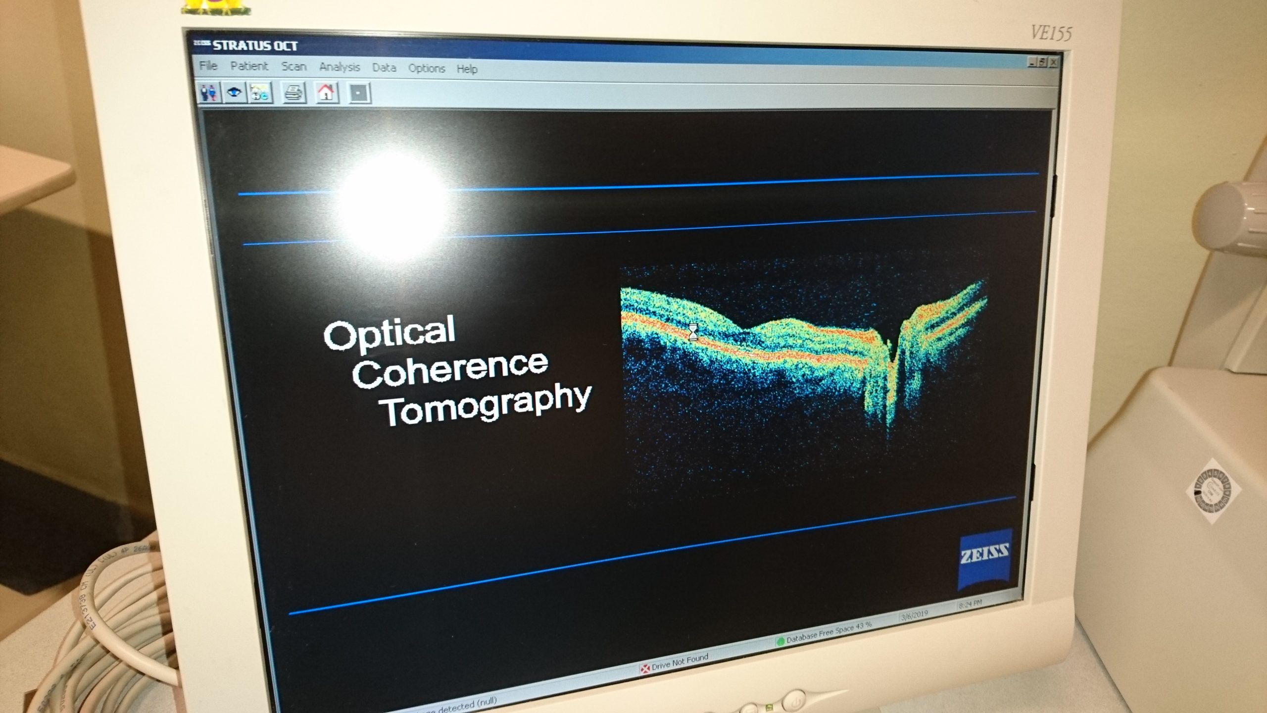 Zeiss OCT Stratus 3000 Tomograph - Optik Mash