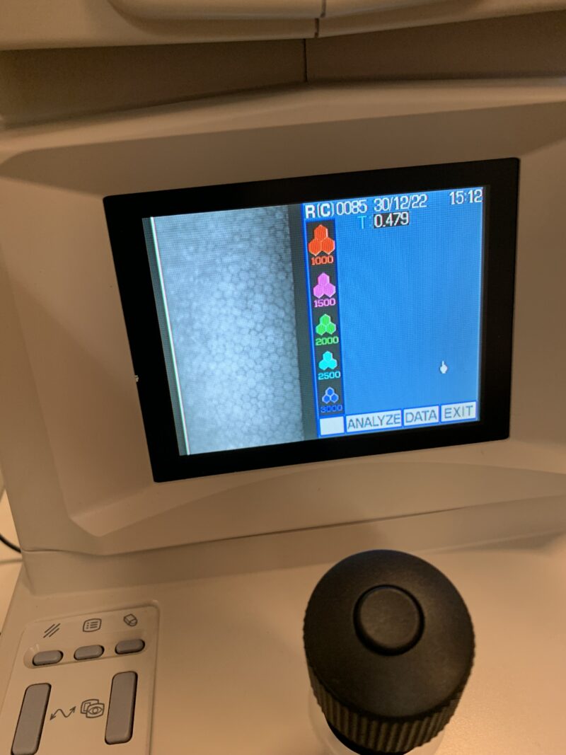 TOPCON SP-3000P Specular Microscope - Optik Mash